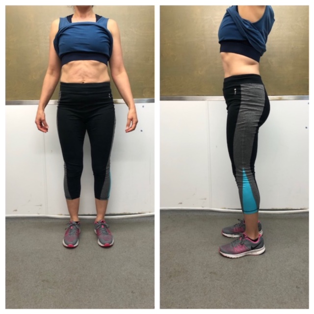 Blast Plan Case Study: Susan - The Blast Plan Blog